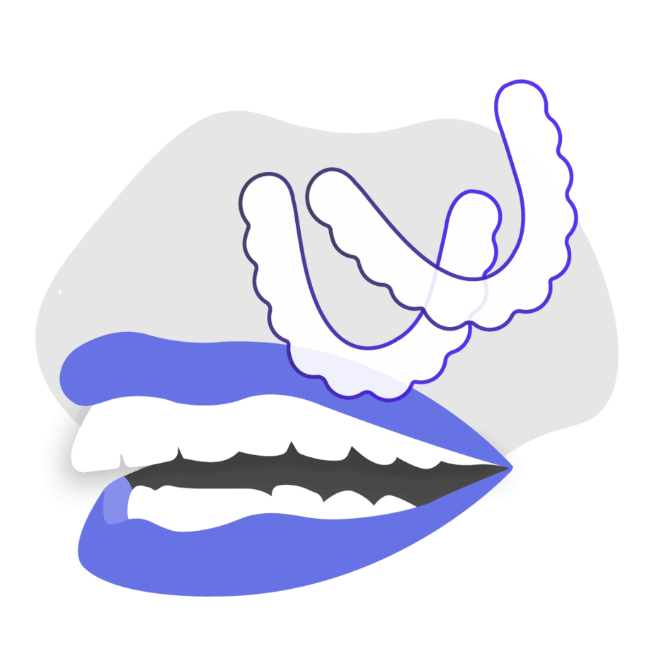 Can Home Teeth Aligners Correct Overjet? - Smile Prep