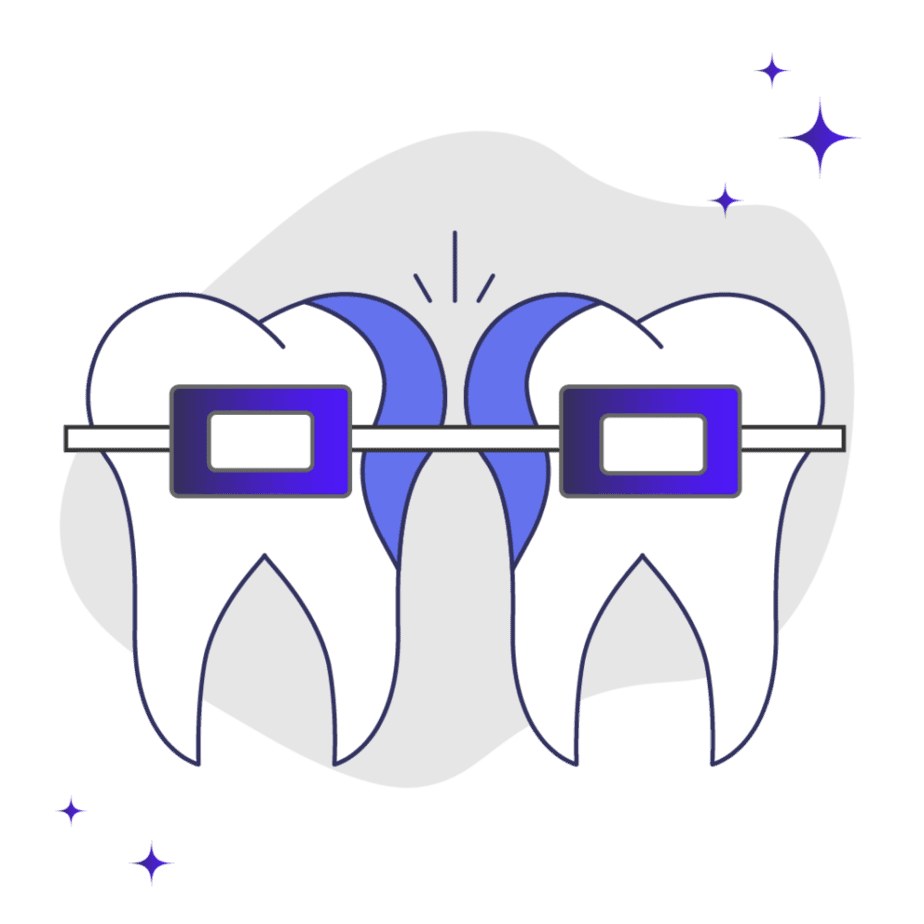 Can Braces Cause Cavities Smile Prep can-braces-cause-cavities-smile-prep