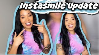 Instasmile Snap-On Veneers: Do They Deliver on Their Promises?