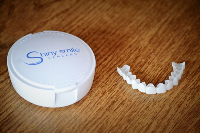 Pop On Veneers Review: Are They Really Worth It?