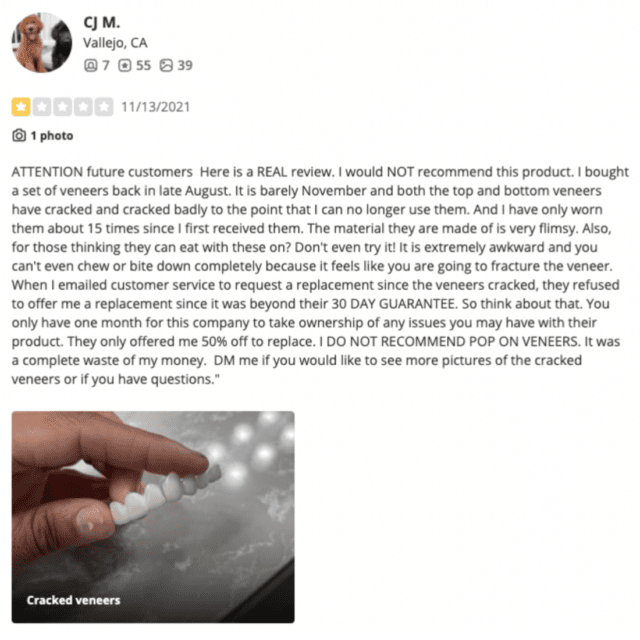 Pop On Veneers Review: Are They Really Worth It?