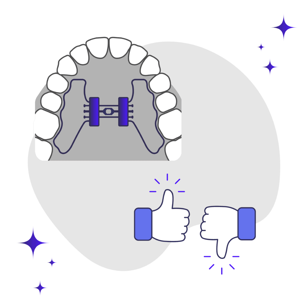 Are Palatal Expanders Effective For Adults? - Smile Prep