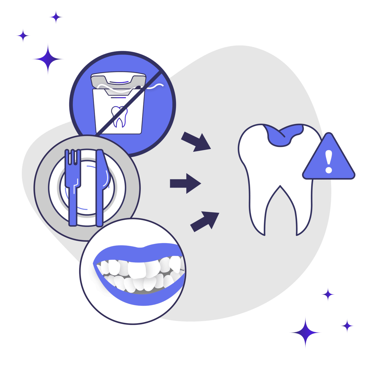 What Causes Cavities? - Smile Prep
